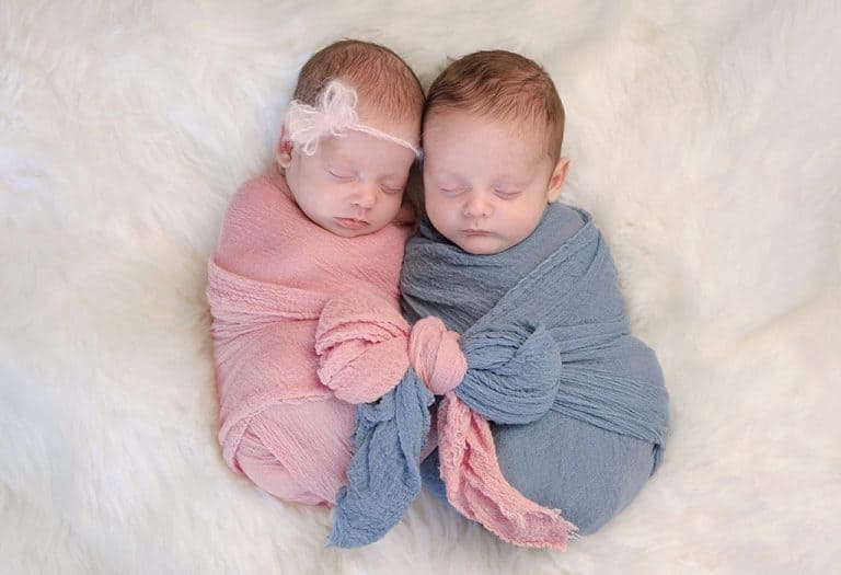 Conjoined Twins Help Explain the Influence of Chiropractic on Immunity